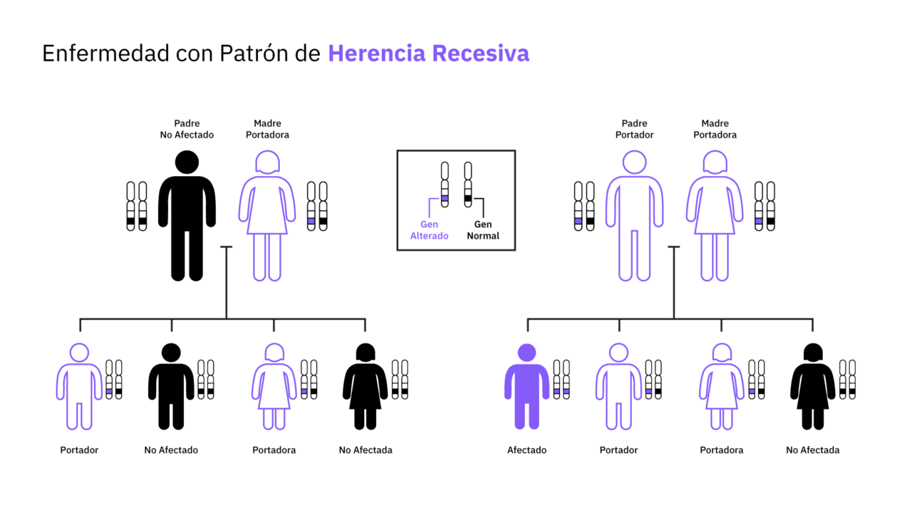 Homocistinuria: conozca más sobre esta enfermedad rara genética